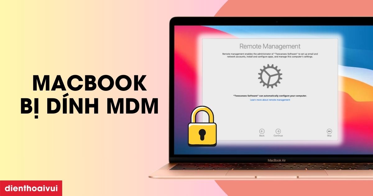 MacBook bị dính MDM là gì? Dấu hiệu và cách xử lý 2025